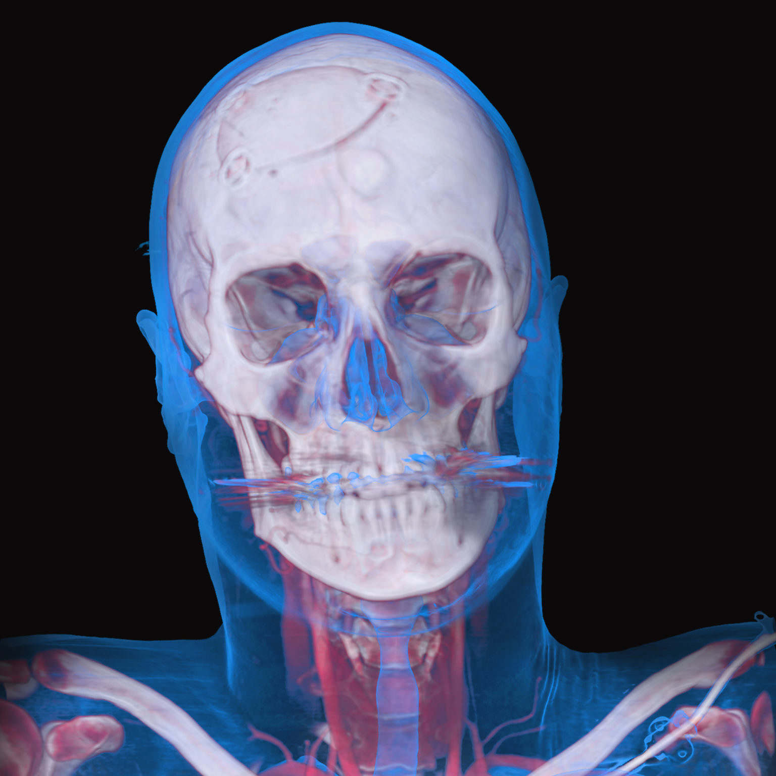 The human anatomy exhibition - Interspectral